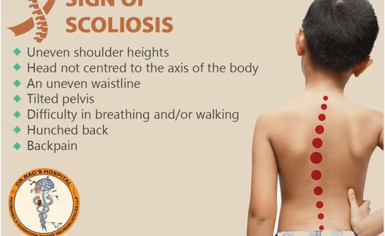 Best Scoliosis Spine Surgery at Dr. Rao’s Hospital