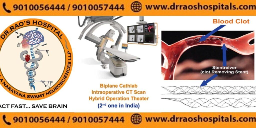 Cranial Nerve Disorder Dr Raos Hospitals 1279